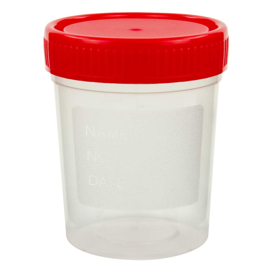 Specimen/Urine Container Non-Sterile 120ml, 100/CS – Kyrios Soter ...